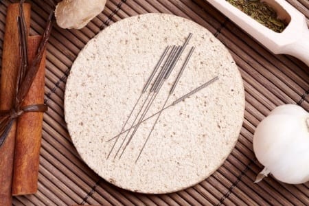 What Are The Risks and Benefits of Acupuncture Therapy?
